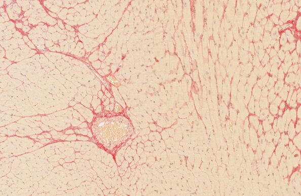 Preclinical 2D Histology: Services & Solutions | Gubra